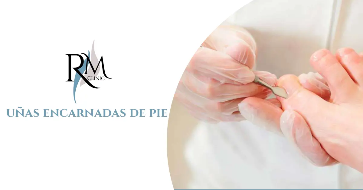 Uñas encarnadas pie - RM CLINIC